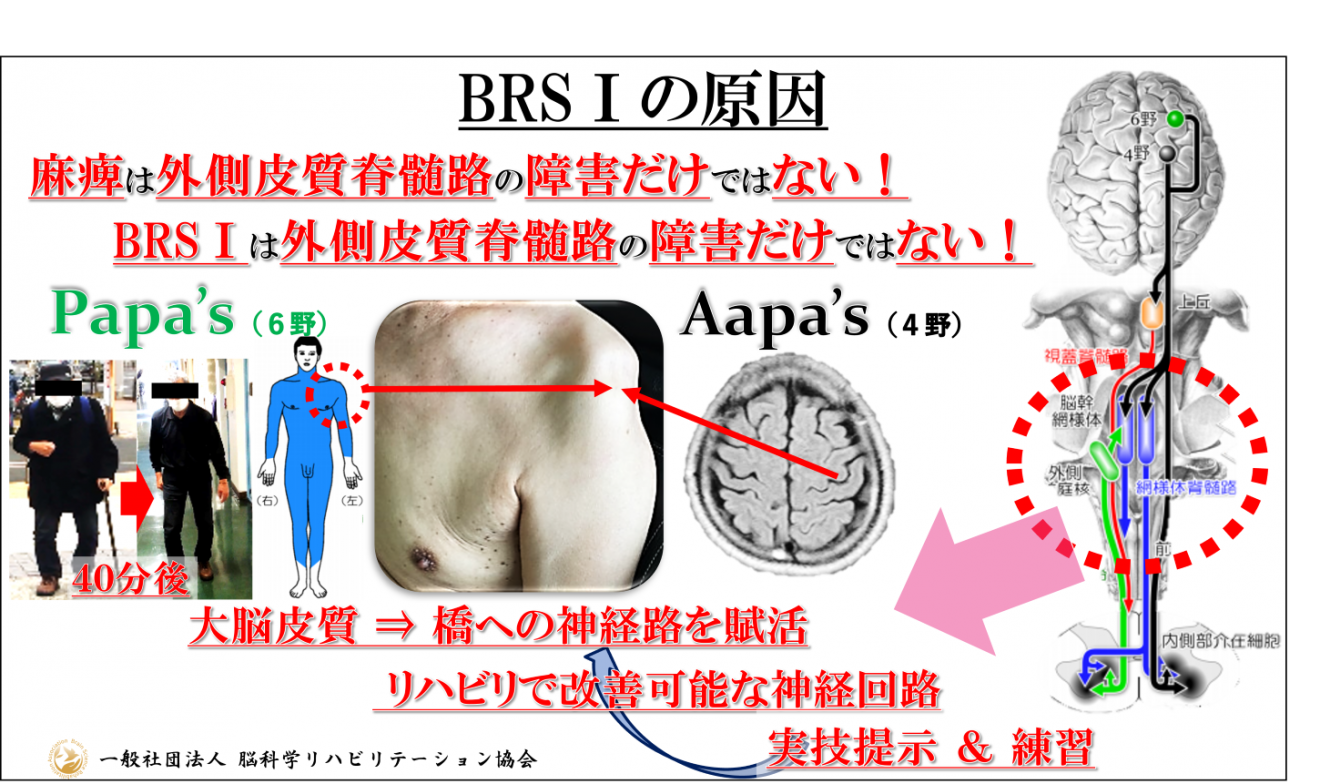 【1万人以上が受講 BRSシリーズがスタートBRSⅠ・姿勢制御】 BRSⅠ・低緊張のメカニズムを理解し神経システムを促通するハンドリング実技 ...